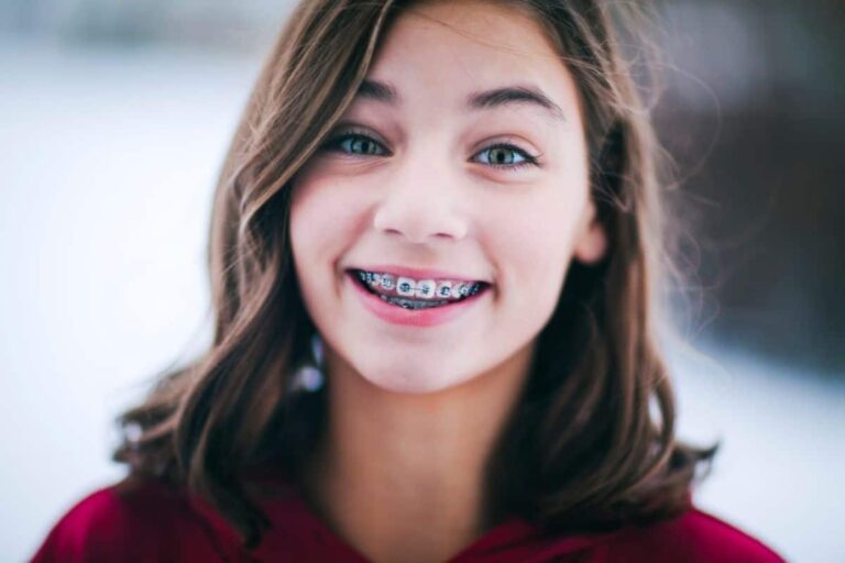Achieving a Perfect Smile with Traditional Braces: What to Expect